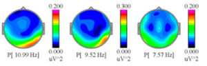 How to interpret qEEG results? | NeuroTraining Strategies
